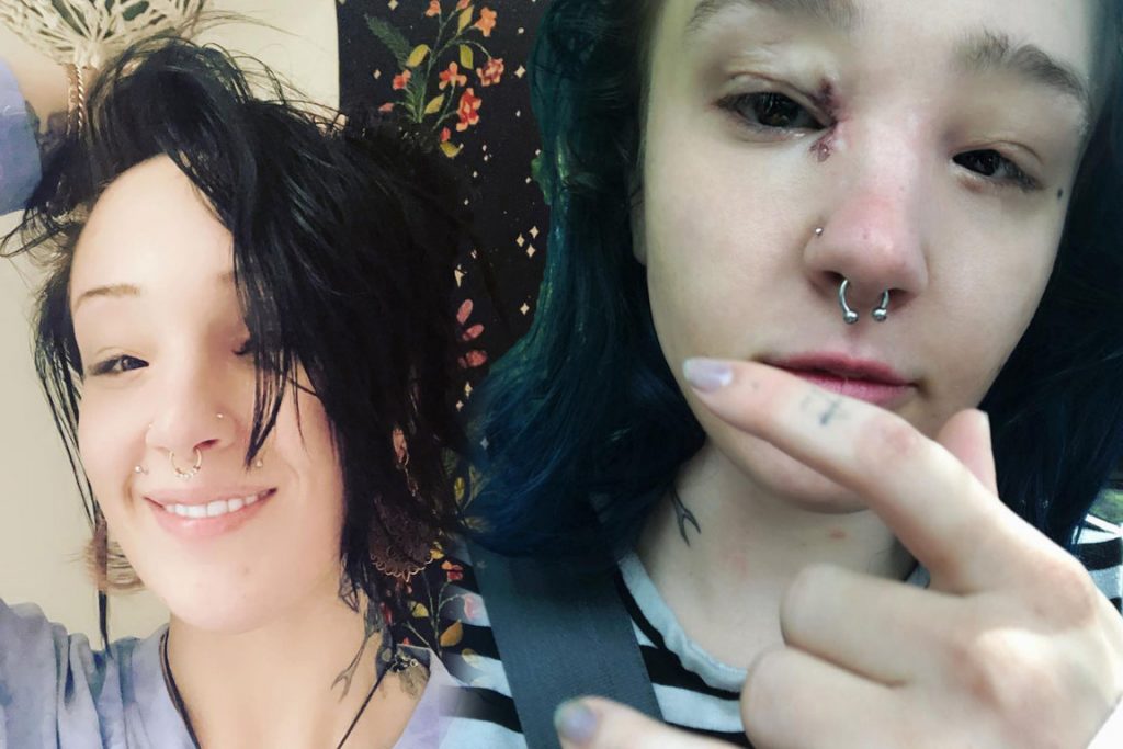 Cause of Death: Hannah Price Age, Dies at 25, Family, Wiki, Children ...