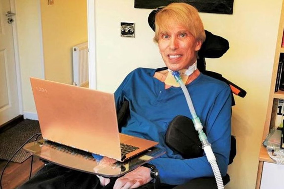 first human cyborg, Dr. Peter Scott-Morgan, dead at aged 64 ...